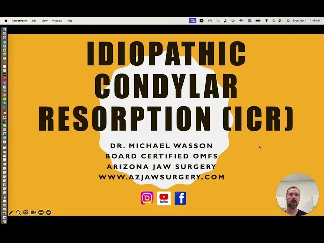 Idiopathic Condylar Resorption Treatment in Scottsdale AZ